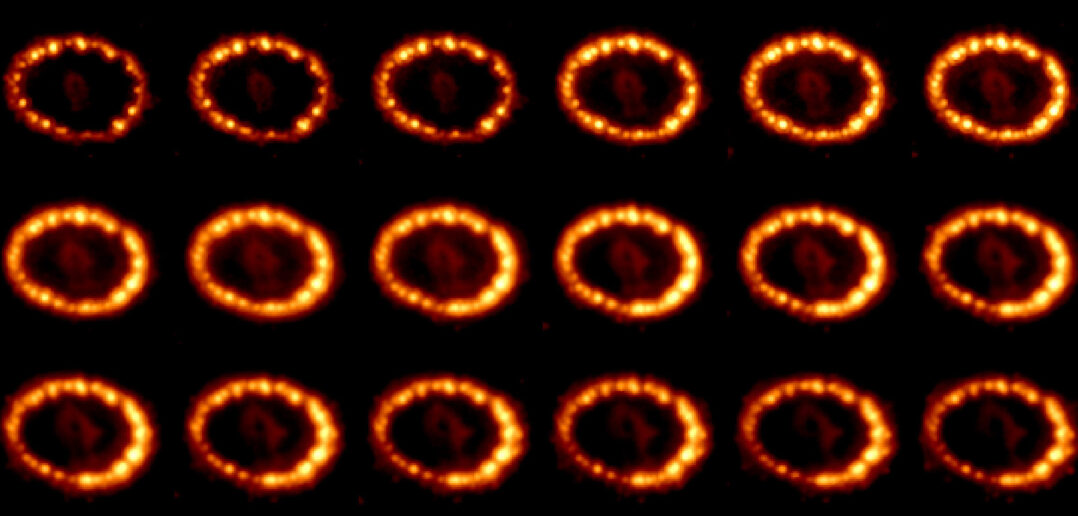 Featured Image: Evolution of a Supernova Ring - AAS Nova